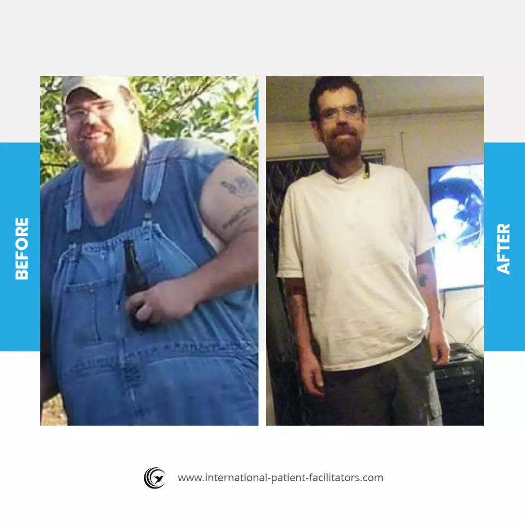 Contact | International Patient Facilitators